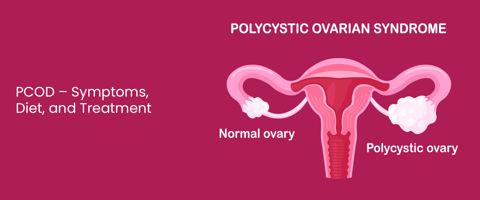 PCOD Symptoms, Causes, and Effective Treatments