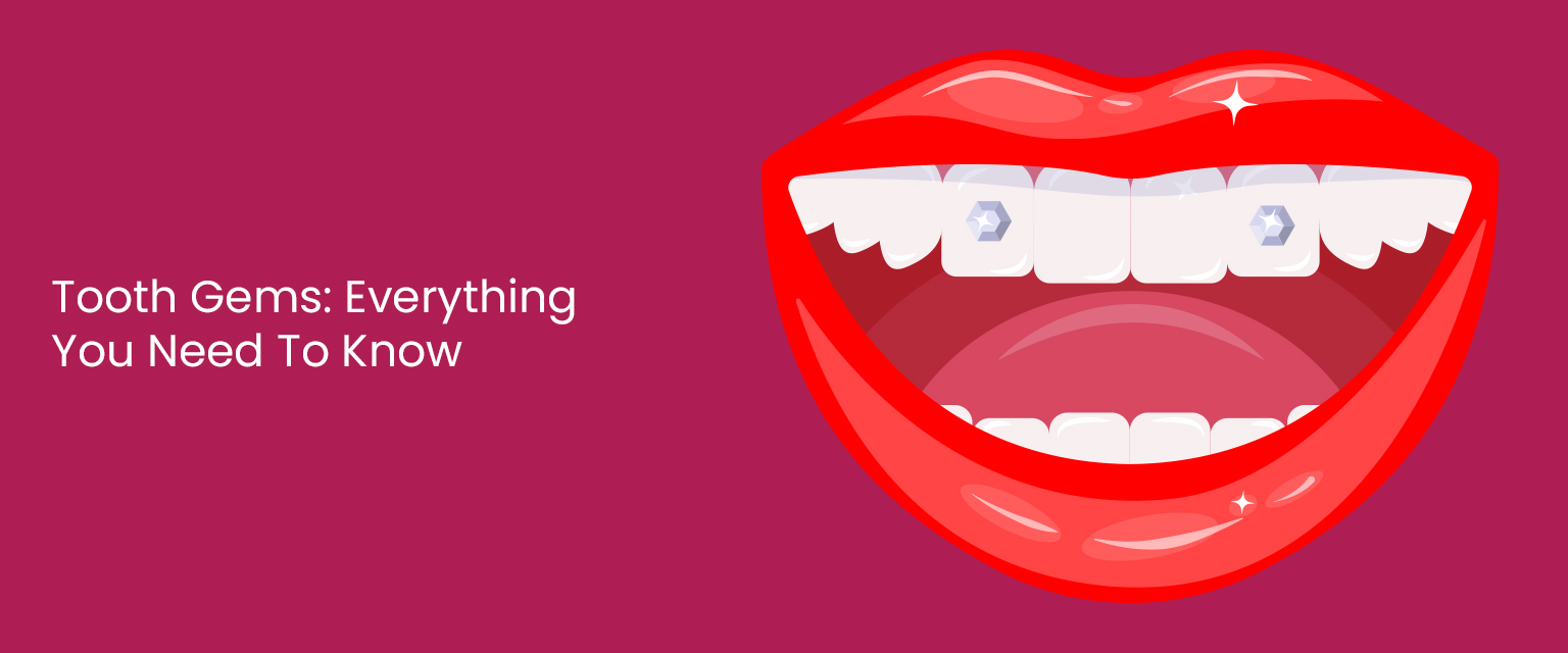 Tooth Gems: Everything You Need To Know - TriLife Hospital