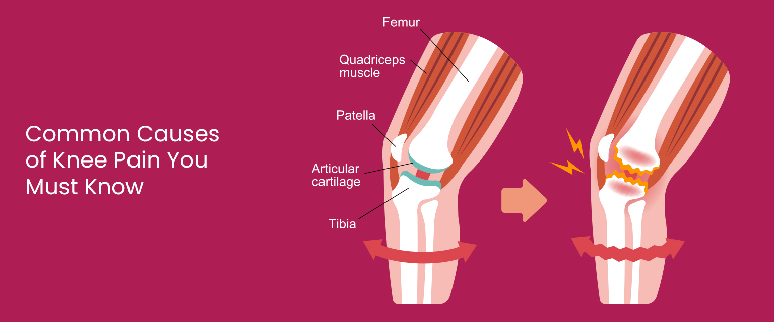Common Causes Of Knee Problems